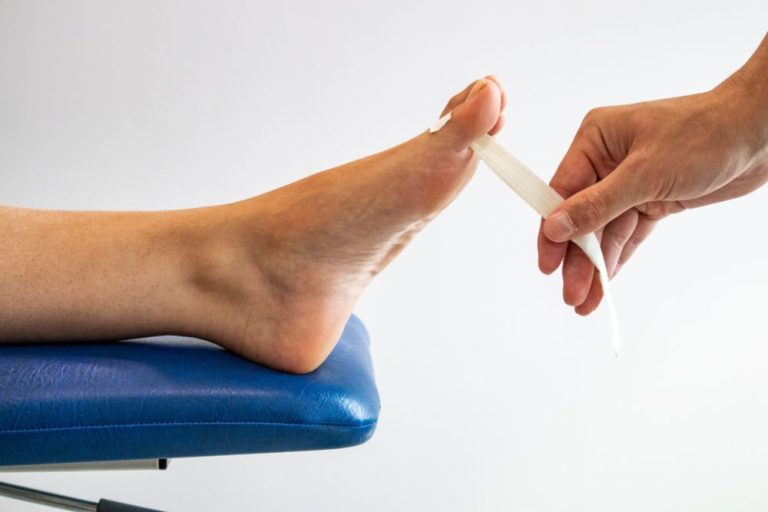 M.20. Foot tape (MTP1) to sustain internal rotation of the proximal ...